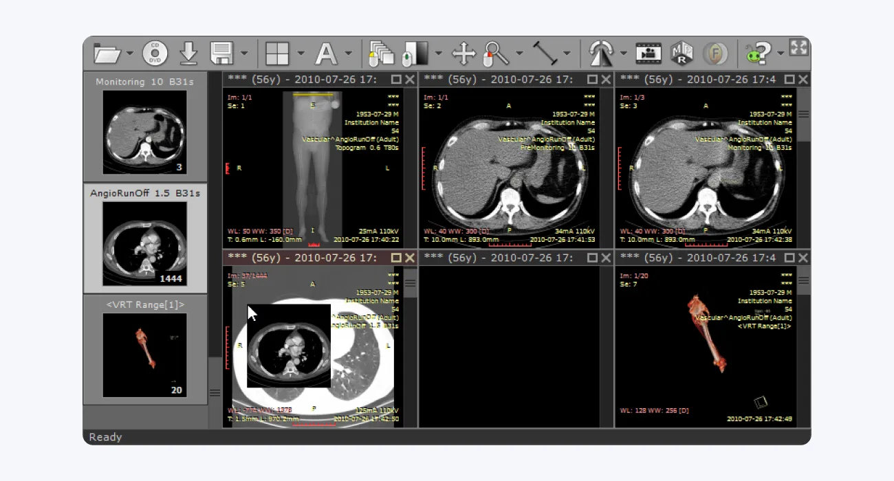 10 Best DICOM Viewers for Medical Images (2023 Update)